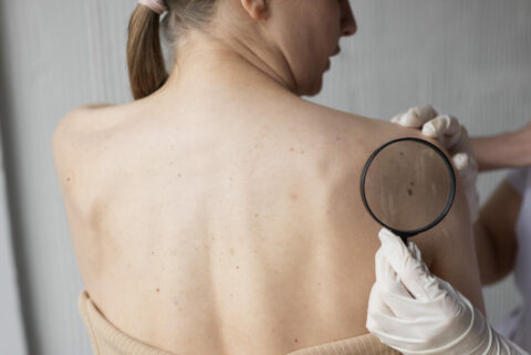 Understanding Skin Cancer and Protecting Yourself from Harmful UV ...